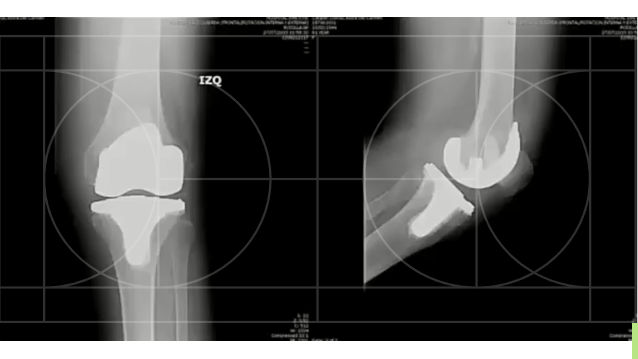 Medial Pivot : Doryos
