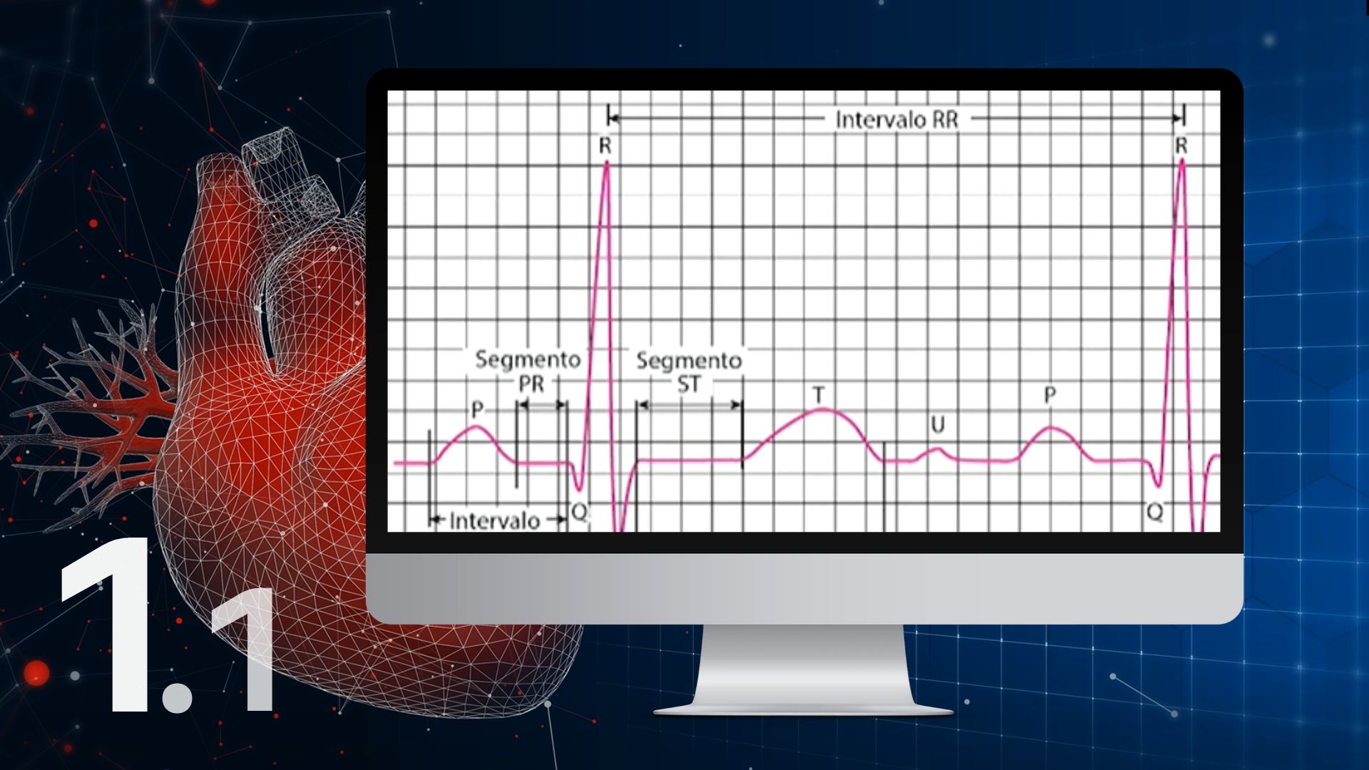1.1. Interpretación básica del electrocardiograma : Doryos