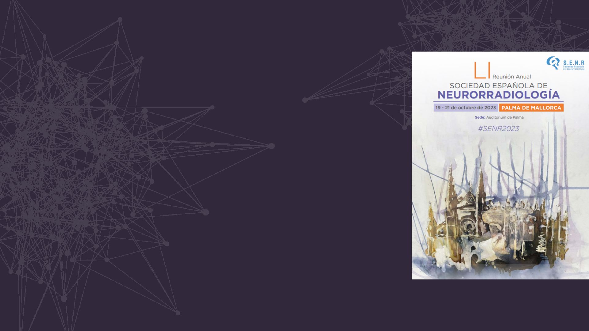 51º Reunión Anual De La Sociedad Española De Neurorradiología Doryos