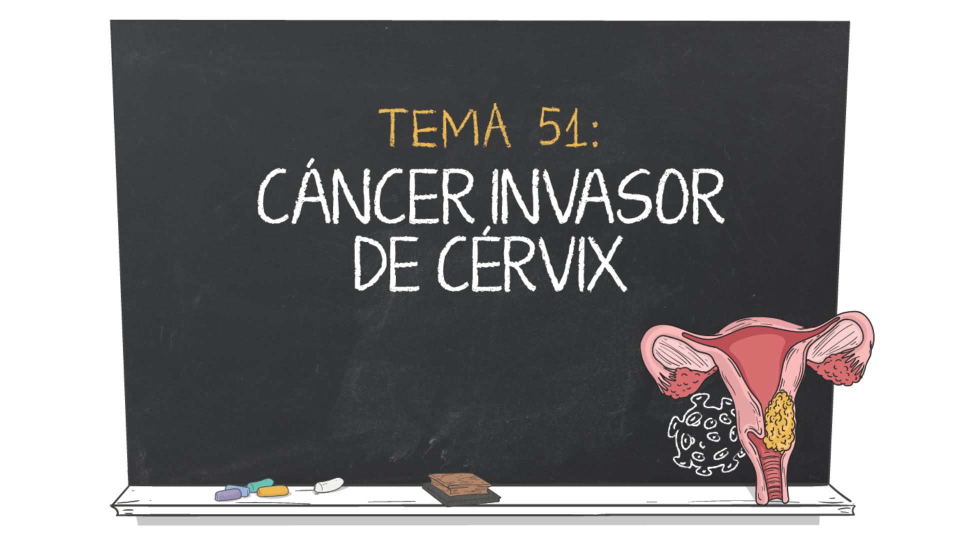Tema 51 Cáncer Invasor De Cérvix Doryos
