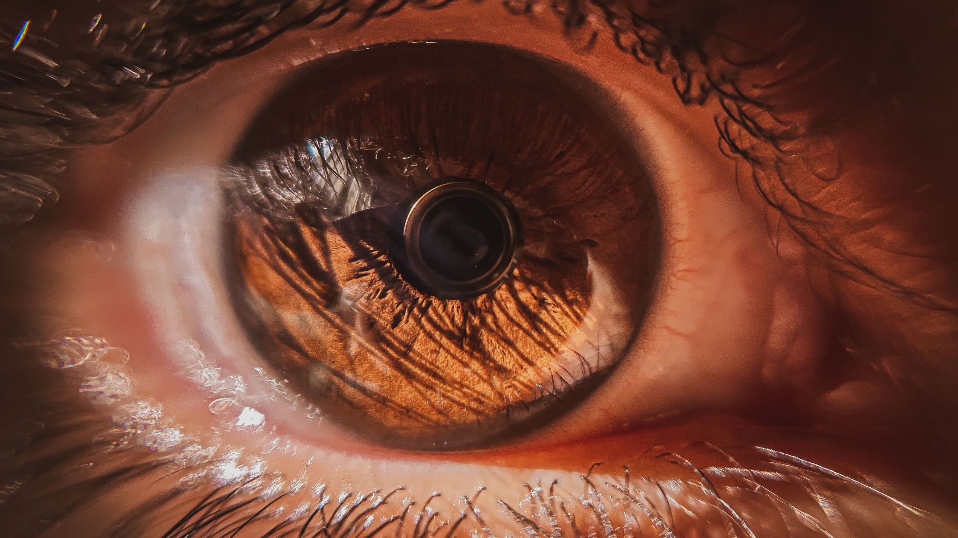 Ojo vago o ambliopía : Doryos