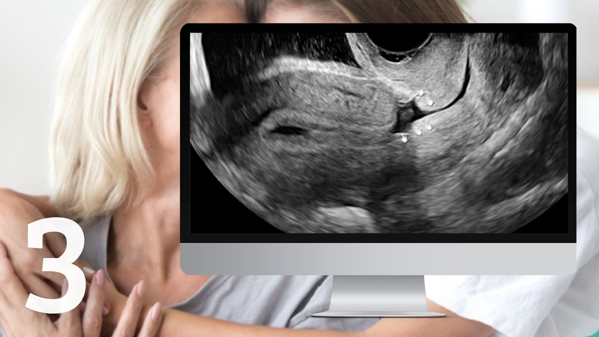 ISTMOCELE - Implicaciones reproductivas y tratamiento, parte 3 : Doryos